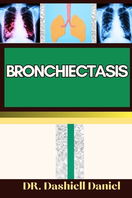 Bronchiectasis: Expert Guide to bronchiectasis Causes, Symptoms ...